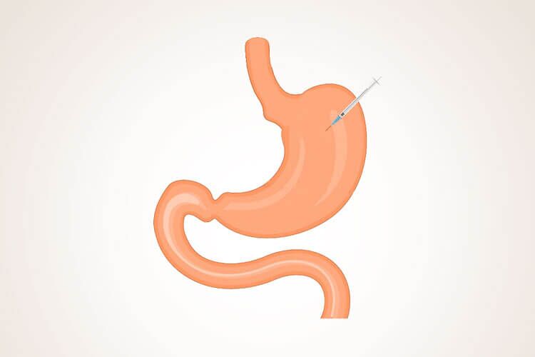 Stomach Botox - TravelMEDI